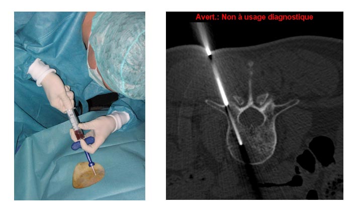 Spine Surgery Salem | Frequently Asked Questions