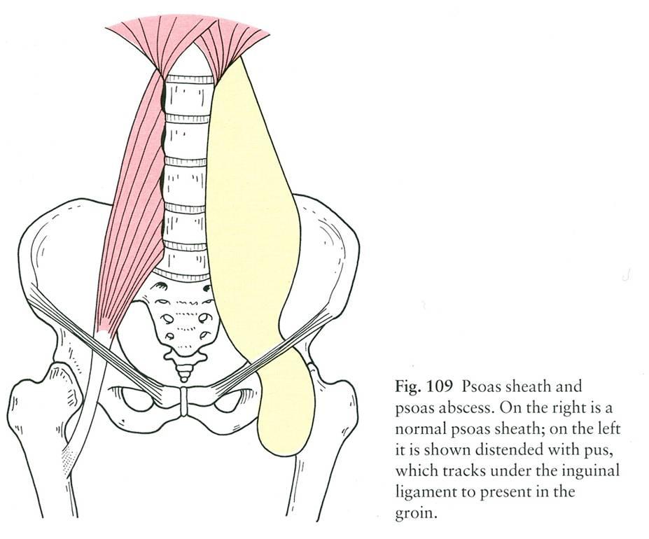 Spine Surgery Salem | Frequently Asked Questions
